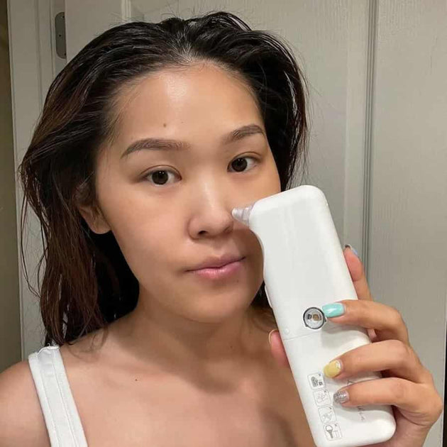 Is Hydro Dermabrasion Right For You? | Lucky Skin
