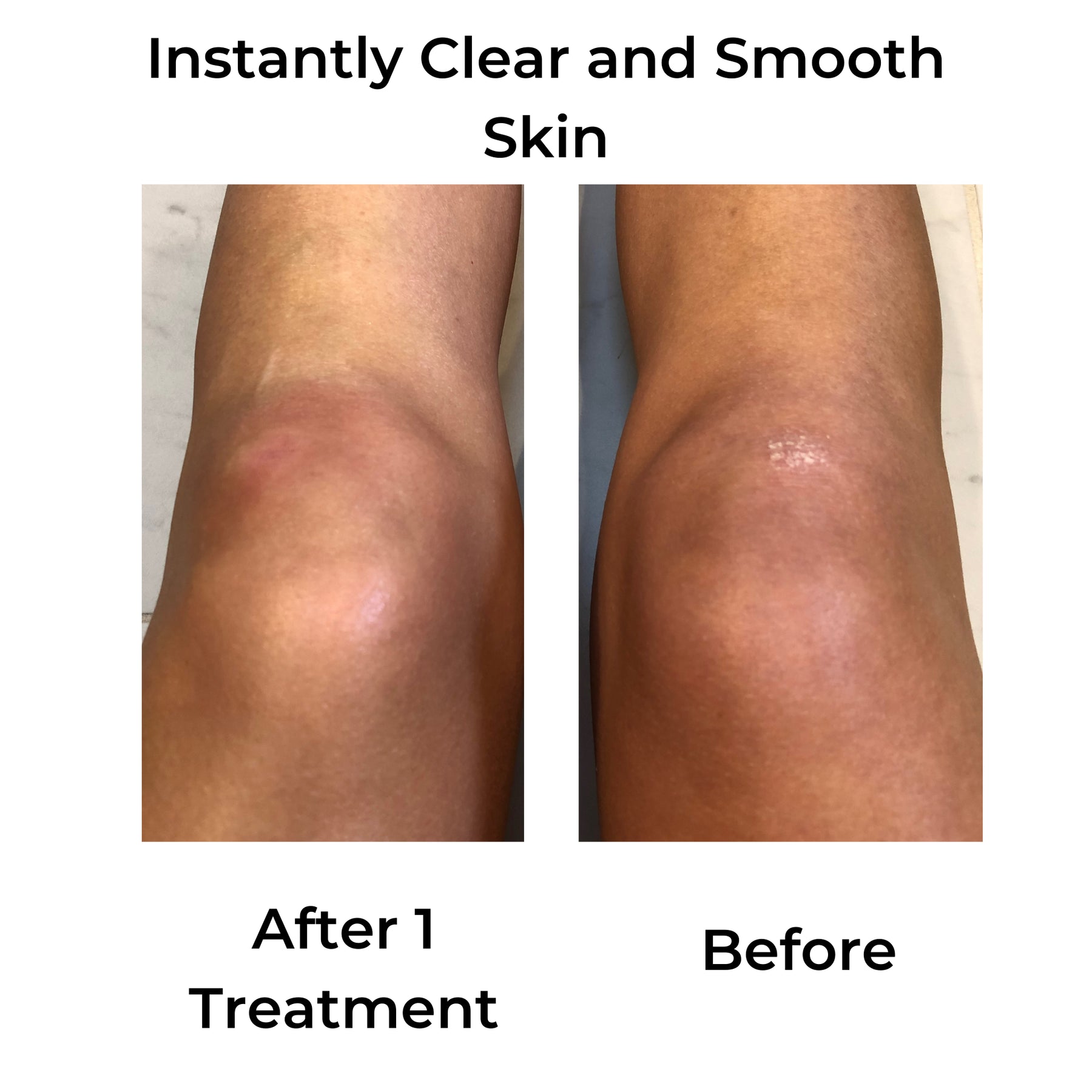 Lucky Skin Hydro | Lucky Skin